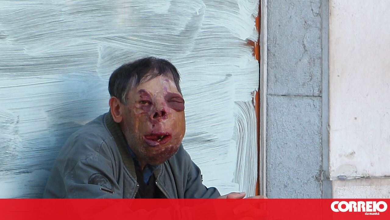 'Homem sem rosto' voltou ao Rossio após operação - Portugal - Correio ...