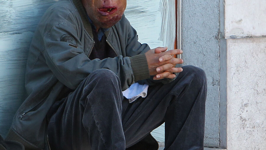 'Homem sem rosto' voltou ao Rossio após operação - Portugal - Correio ...