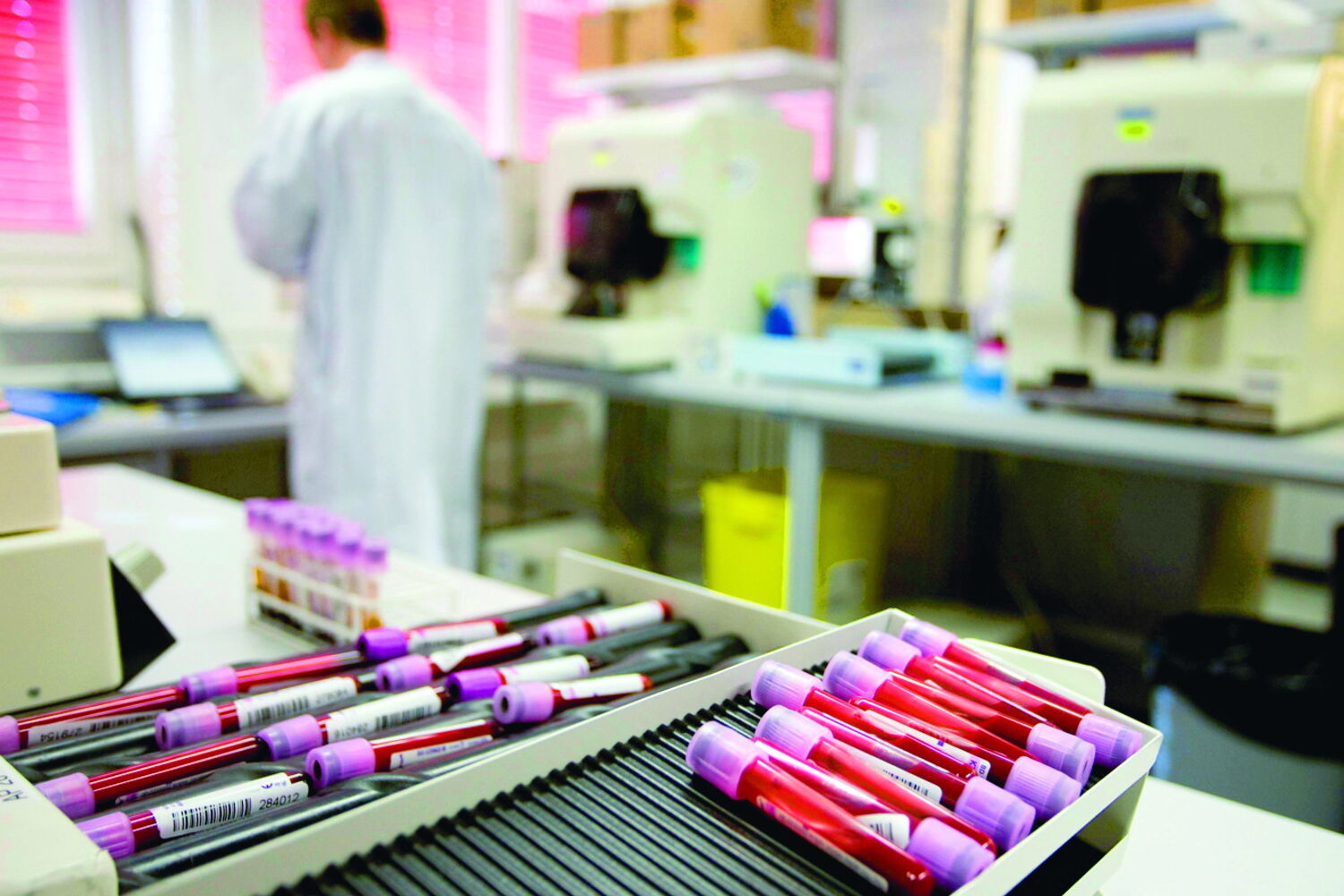 Mulher espera três meses para saber se tem HIV depois de médico fazer ...