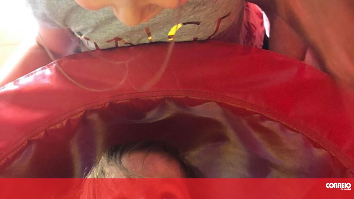 Conheça Isla, a única menina no mundo com a doença popularizada pelo ...