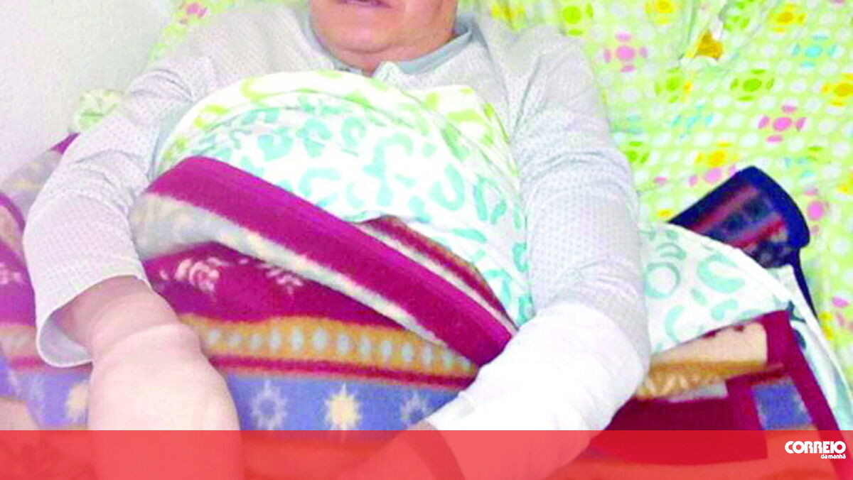 Homem queimado pode ficar sem mãos - Sociedade - Correio da Manhã